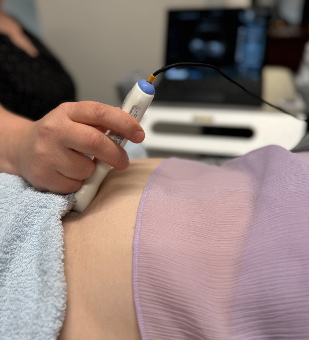 Rehabilitative Ultrasound Imaging – Thrive Again